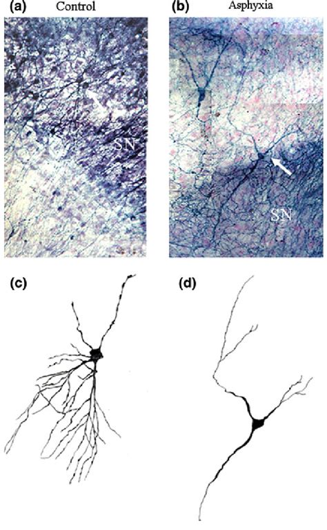 Neurite Atrophy Induced By Perinatal Asphyxia Tyrosine Hydroxylase