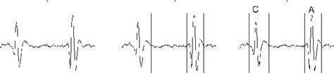The Consecutive Stages Of Identification Process A The Signal Before