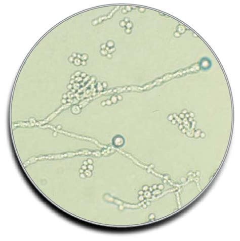 BD BBL Prepared Plated Media Corn Meal Agar With Polysorbate Deep Fisher Scientific