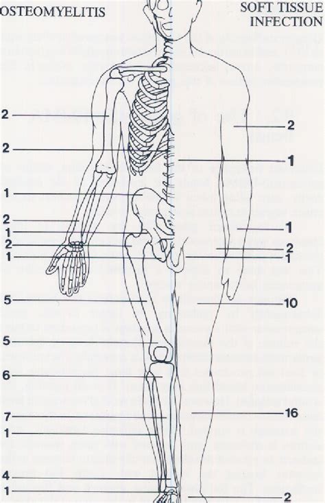 14 Review Ofthe Treatments With Gentamicin Pmma Beads During The Period