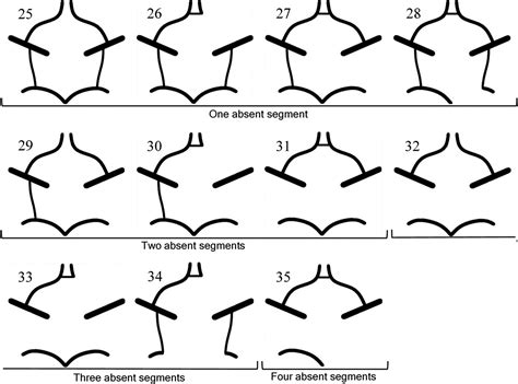 A New Classification System For The Anatomical Variations Of The Human