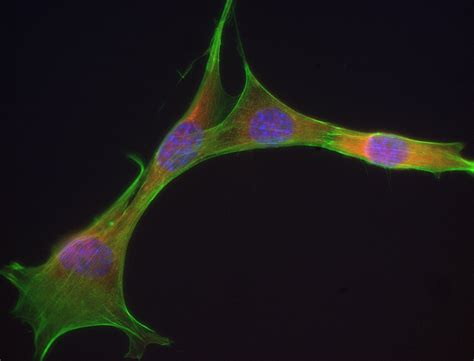 Angiogenesis Analyzer For Imagej Gilles Carpentier Research Web Site