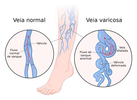 Sistema Venoso ANATOMIA Anatomia II Sinta a vibração jogos de