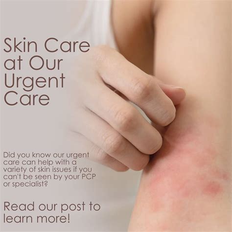 Excel Urgent Care Of Ny And Nj On Linkedin Did You Know We Treat Common