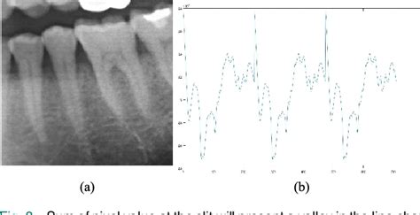 Figure 8 From Automated Detection System Based On Convolution Neural Networks For Retained Root