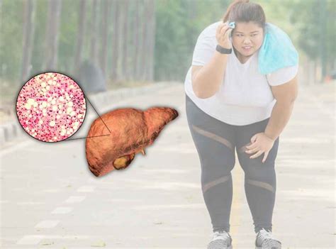 Enfermedades Del Sistema Digestivo Causas Y Síntomas