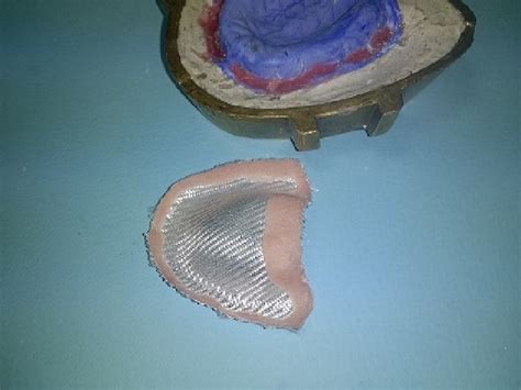 The Addition Of Self Polymerizing Resin Along The Outer Perimeter Of Download Scientific