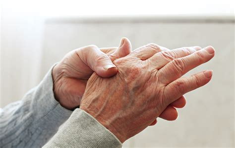 Systemic Scleroderma Diagnosis And Treatment In The Best Clinics