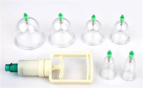 Hijama The Powerful Islamic Cupping Therapy Explore Islam