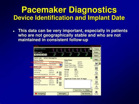 Ppt Pacemaker Diagnostics Powerpoint Presentation Free Download Id