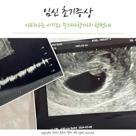 임신초기 주의사항 초기 임신 증상 나타나는 시기 네이버 블로그