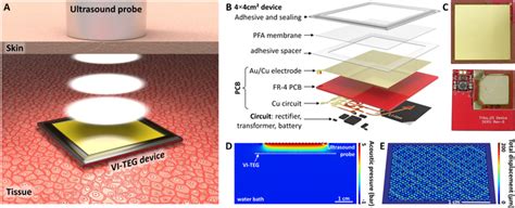 체내 삽입형 의료기기 新 충전법 초음파 마찰전기