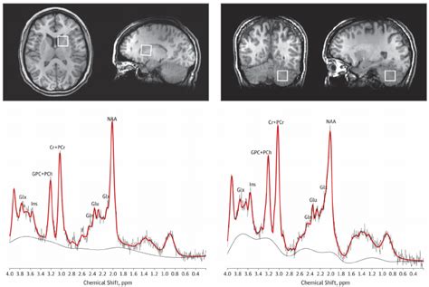 Voxel Placement In 2 Regions Of Interest The Right Associative