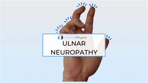 Ulnar Neuropathy Clinical Physio Membership