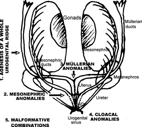 Diagram Showing The Embryology Of The Female Genital Tract And The