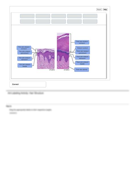 SOLUTION Unit Lab Integumentary System Studypool