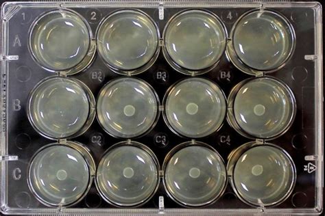 Liofilchem Fosfomycin Agar Dilution Panel Launch Diagnostics