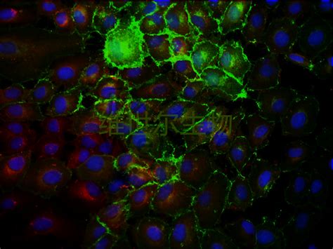 免疫荧光 If 组织染色 实验服务 维世尔生物