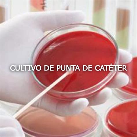 CULTIVO DE PUNTA DE CATÉTER OVLAB O V Laboratorios