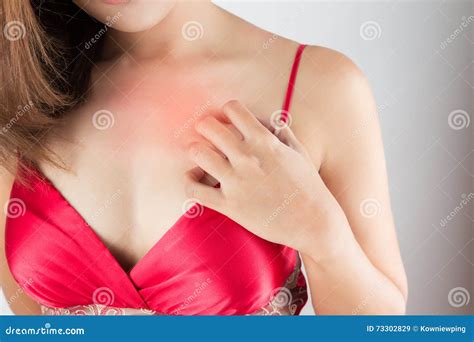 Woman Scratching Her Itchy Chest Stock Image Image Of Irritate