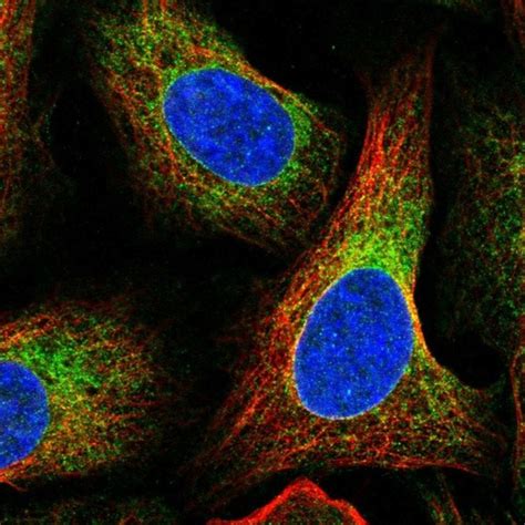 Rabbit Polyclonal Anti Sptlc1 Antibody Buy For Research Highly Specific Rigorously
