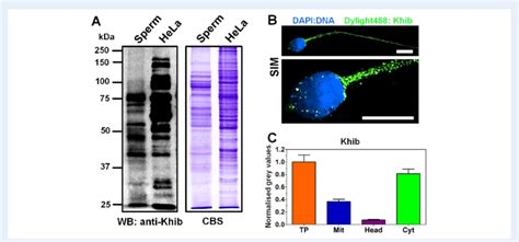 The Presence Of Lysine 2 Hydroxyisobutyrylation In Human Sperm A