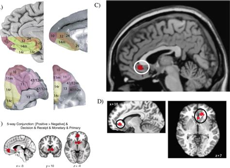 A Architectonic Parcellation Of Human And Macaque Ventromedial Top Download Scientific