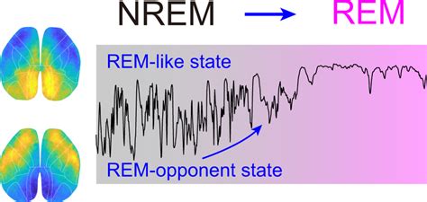 Diagram Illustrating Cortical Activity During Nrem To Rem Download Scientific Diagram
