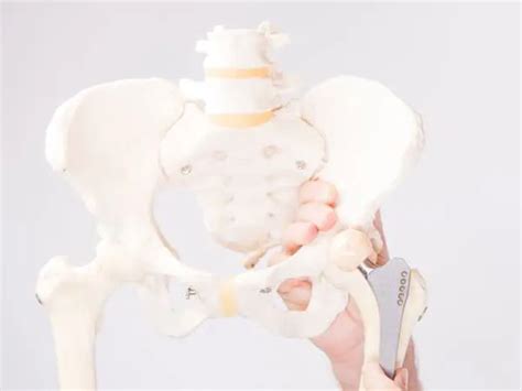 Hip Hemiarthroplasty Btm Layout Total Hip Replacement Bangalore Hip