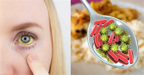 Cómo se contagia la hepatitis A puede dar por los alimentos Salud180