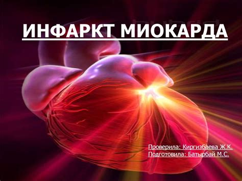 Инфаркт миокарда - презентация онлайн
