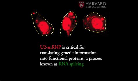 Assembly Failure Harvard Medical Babe