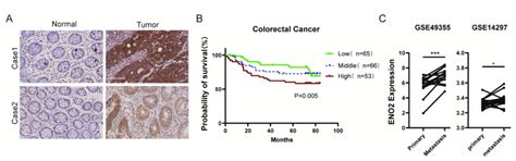 Eno2 Was Upregulated In Crc Tissues And Negatively Correlated With Poor
