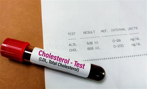 High Cholesterol Blood Sample Stock Photos Free Royalty Free Stock