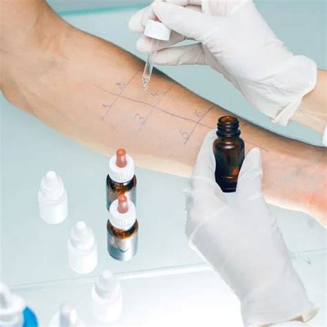 Immuno Allergologist Divine Grace Medical Center Dgmc Hospital