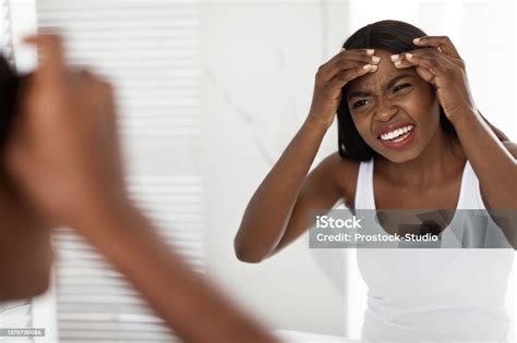 거울 근처 이마에 여드름을 터지는 문제 피부와 불행한 흑인 여자 여드름에 대한 스톡 사진 및 기타 이미지 여드름 여자