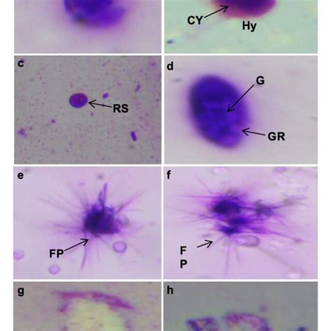 Light Micrographs Showing Different Types Of Normal And Abnormal