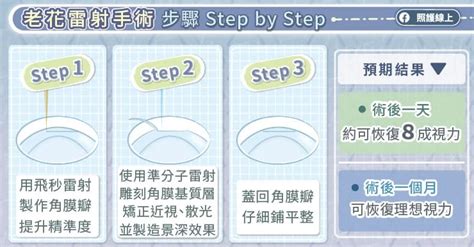 做過近視雷射，還能做老花雷射嗎？眼科醫解答：確認「這點」就可以uho優活健康網