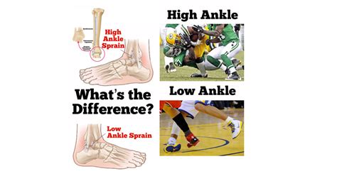 Physiotherapy Blog Andre Rickenbach