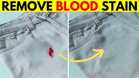 How To Get Blood Out Of Blue Jeans Projects Linguistics