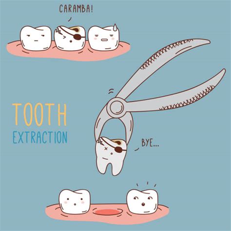 Tooth Extraction Tool Illustrations Royalty Free Vector Graphics