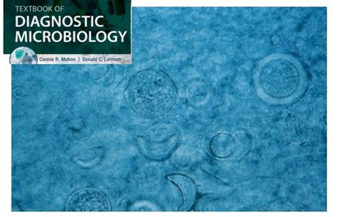 نمای میکروسکوپی گونه های کوکســیدیوئیدس Coccidioides Spp آزمایشگاه مجازی میکروب شناسی