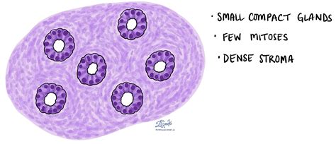 Proliferative Endometrium Mypathologyreportca