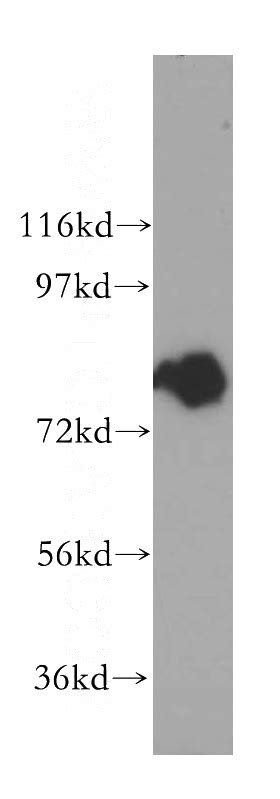 Inpp5b Rabbit Polyclonal Antibody