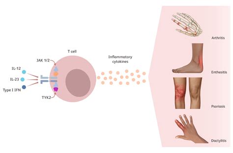 Tyk2 Tyrosine Kinase 2 Pathway