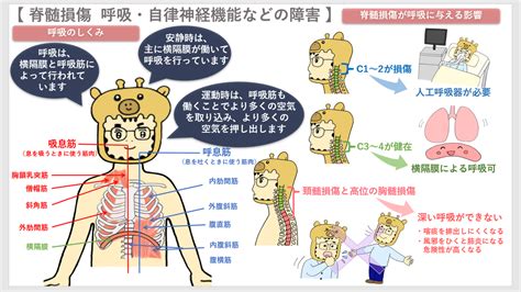脊髄損傷⑤呼吸自律神経機能などの障害 交通事故コラム キリン先生の交通事故講座 だいち法律事務所
