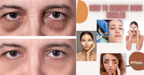 How To Remove Dark Circles At Home Naturally 10 Foods To Eat