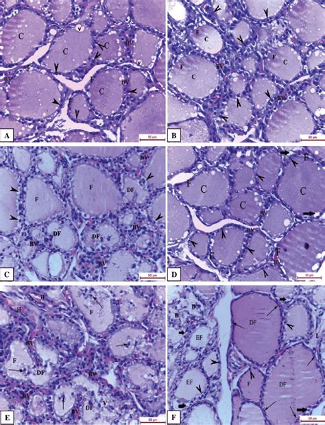 Thyroid Gland Morphology In Different Age Groups Of Control And Nigella