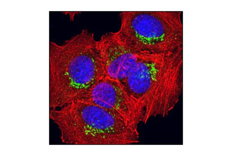 Er And Golgi Associated Marker Proteins Antibody Sampler Kit Cell