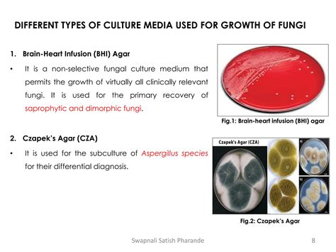 Cultivation Isolation And Staining Of Fungal Culture Pdf